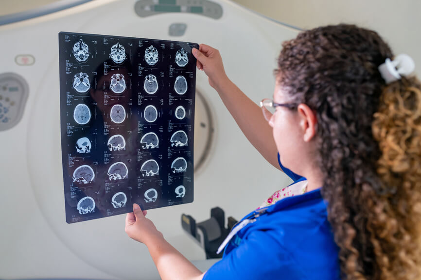 What is Neuroplasticity and Why is It Important?